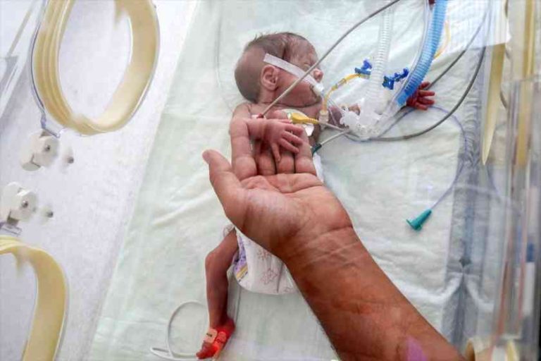 Top 10 smallest newborn babies in the world - Top Tens