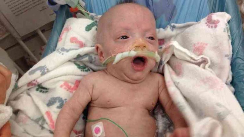 Top 10 smallest newborn babies in the world - Top Tens